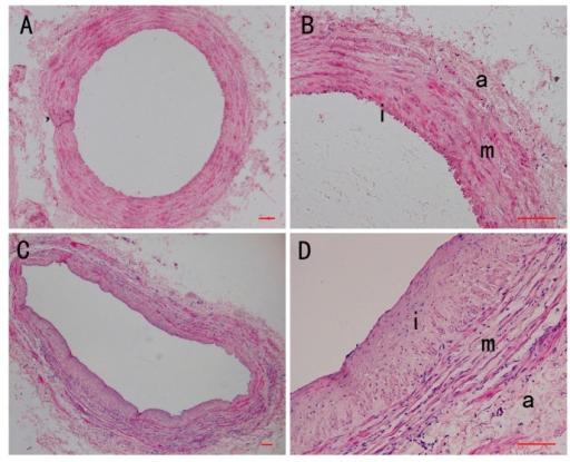 Histological Structure Of The Vein Wall Hande Staini Open I