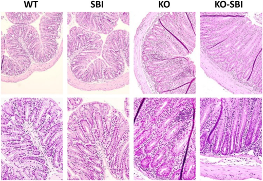 Colon Histology Labeled Colon Histology Labeled