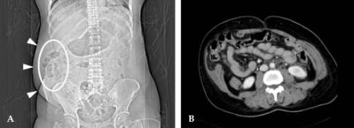 Preoperative Contrast Enhanced Ct Scans A Initial Sc Open I