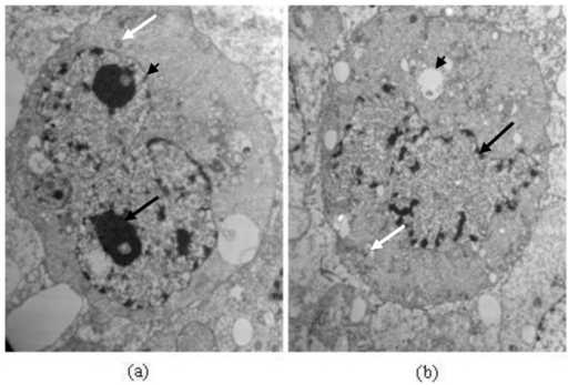 Electron Micrographs Of A549 Cells Magnification 8000 Open I
