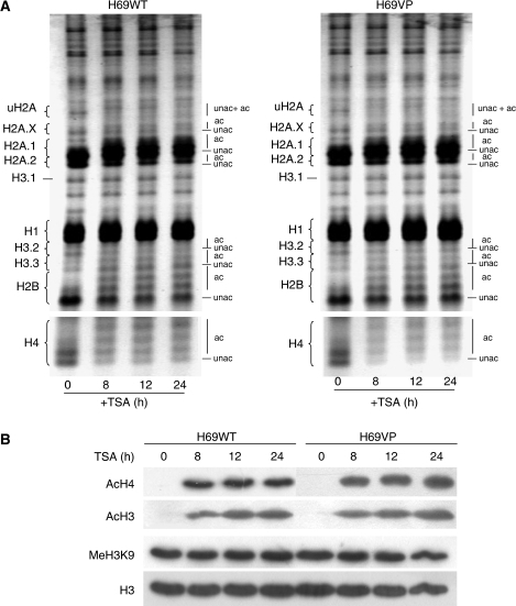 Trichostatin A Tsa Induces Global Histone Acetylation Open I