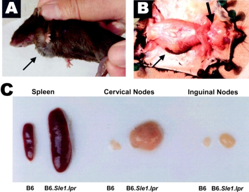 B6sle1lpr Mice Exhibit Prominent Splenomegaly And Lymphadenopathy As Early As 3 Mo Of Age A